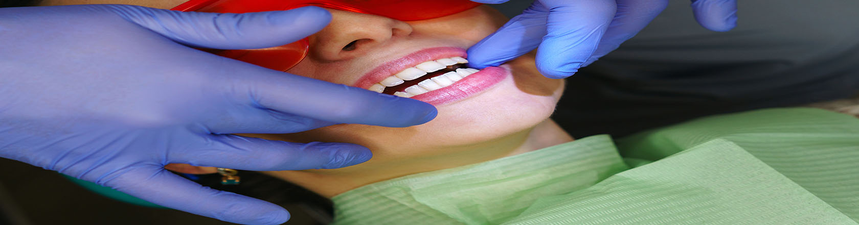 Gingivectomy Paoli - Bleeding Gum Treatment - Malvern, Berwyn | Think ...